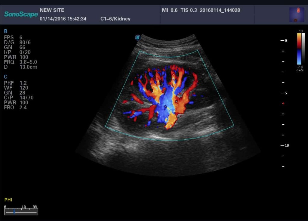 S8 EXP Portable Ultrasound System - Innologic
