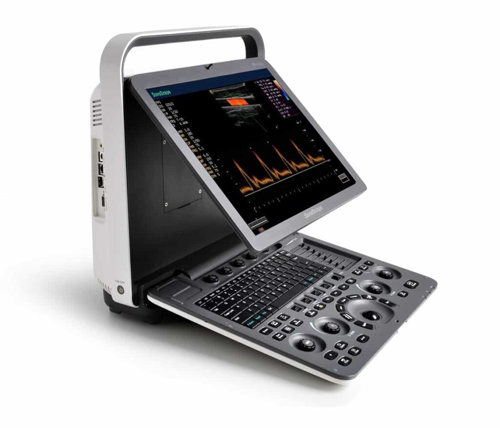 S8 EXP Portable Ultrasound System - Innologic